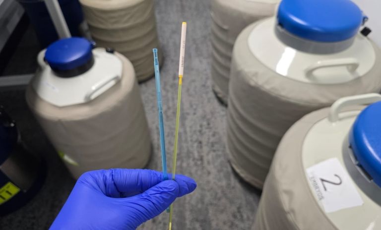 What to Expect at Ovum Pick-Up (OPU) | Nbryo